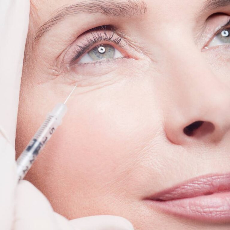 Botox® Training Chart: A Guide for Practitioners - IAPAM